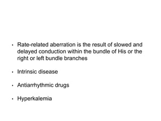 Rate dependent Bundle Branch Block | PPTX