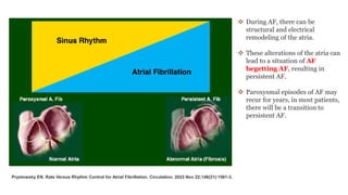 Rate vs Rhythm control for Atrial Fibrillation | PDF