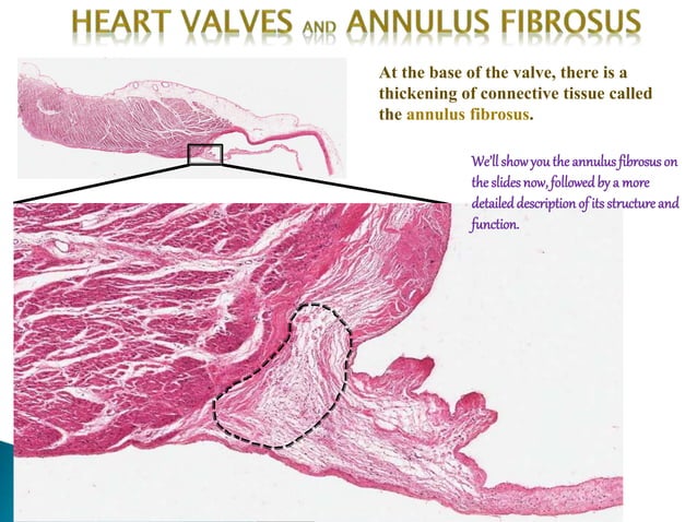 Descripition of heart and purkinje fibres | PPTX | Heart and ...