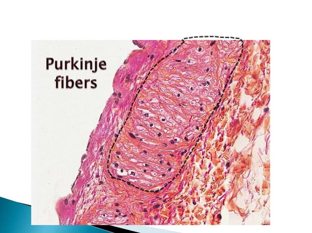 Descripition of heart and purkinje fibres | PPTX | Heart and ...