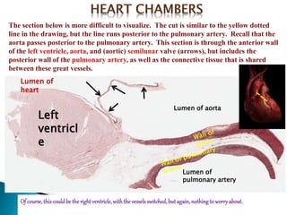 Descripition of heart and purkinje fibres | PPTX