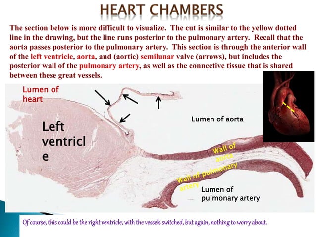 Descripition of heart and purkinje fibres | PPTX | Heart and ...