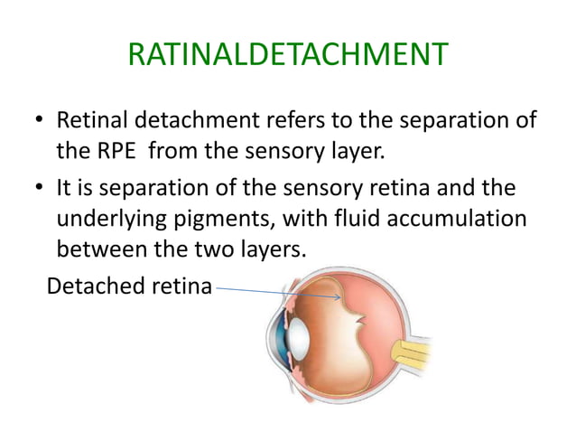 Retinal detachment | PPTX | Eye and Vision Conditions | Diseases and ...