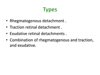 Retinal detachment | PPTX