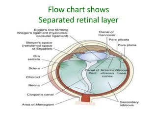 Retinal detachment | PPTX