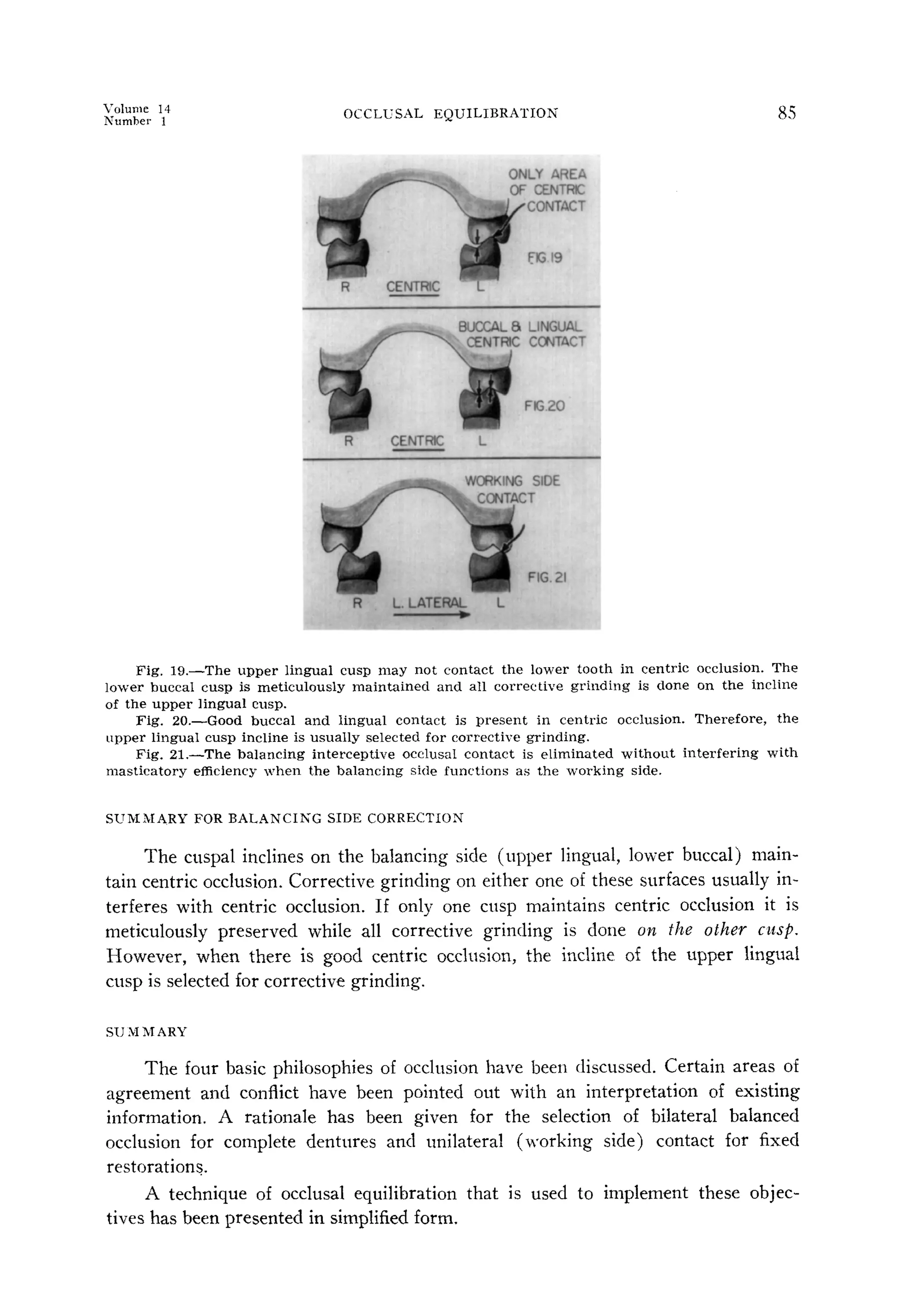 Rationale-and-technique-for-occlusal-equilibration.pdf