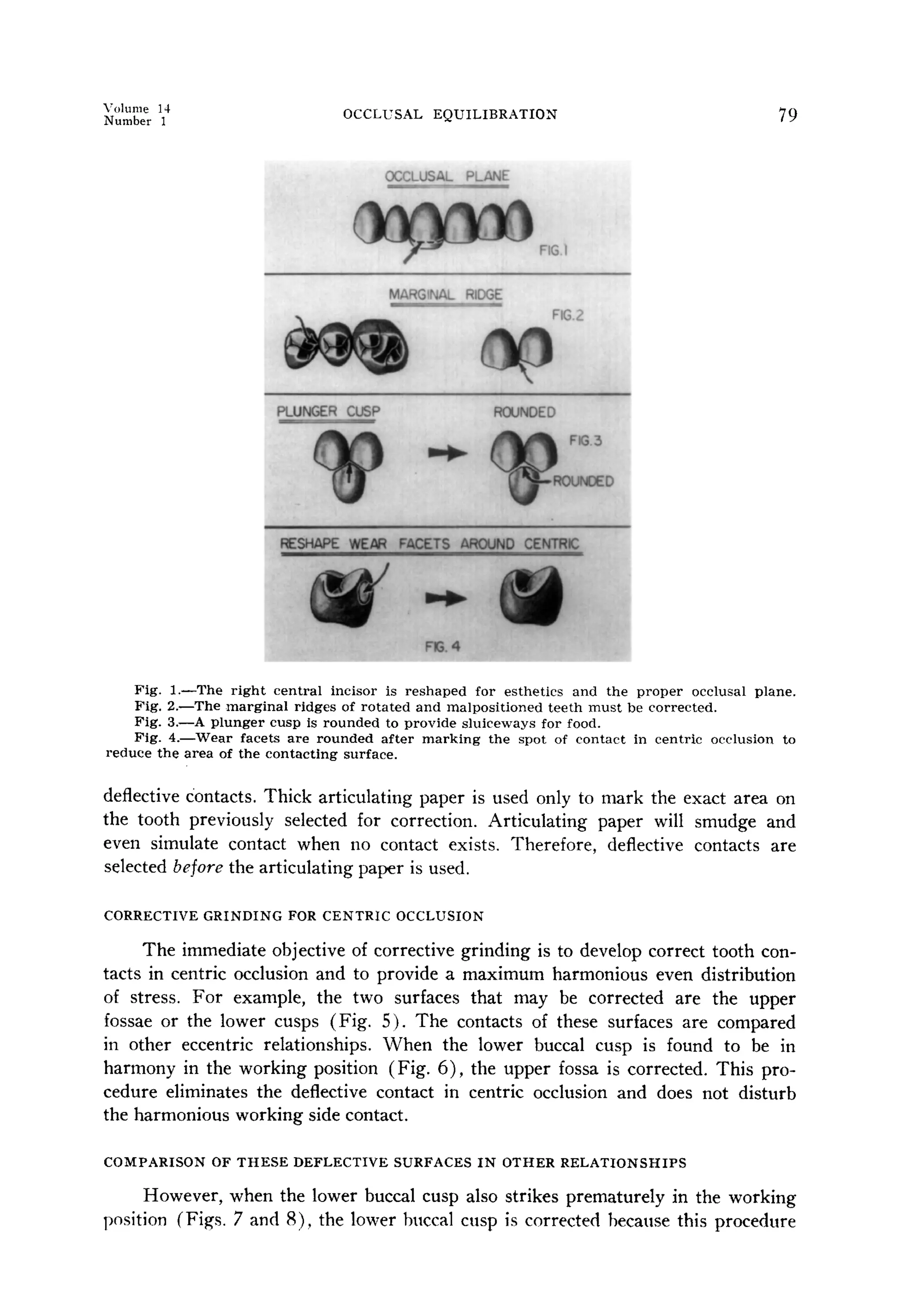 Rationale-and-technique-for-occlusal-equilibration.pdf