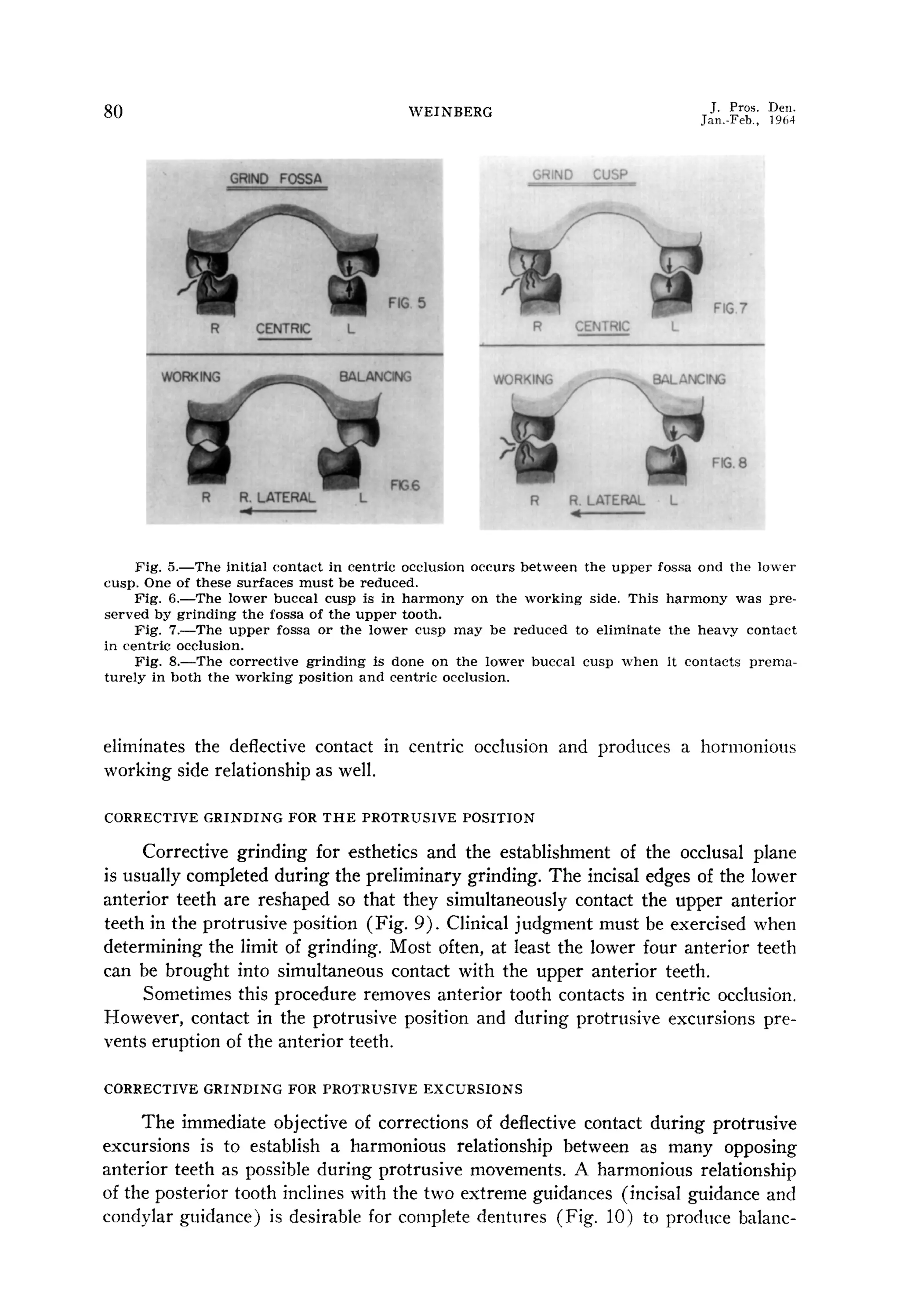 Rationale-and-technique-for-occlusal-equilibration.pdf