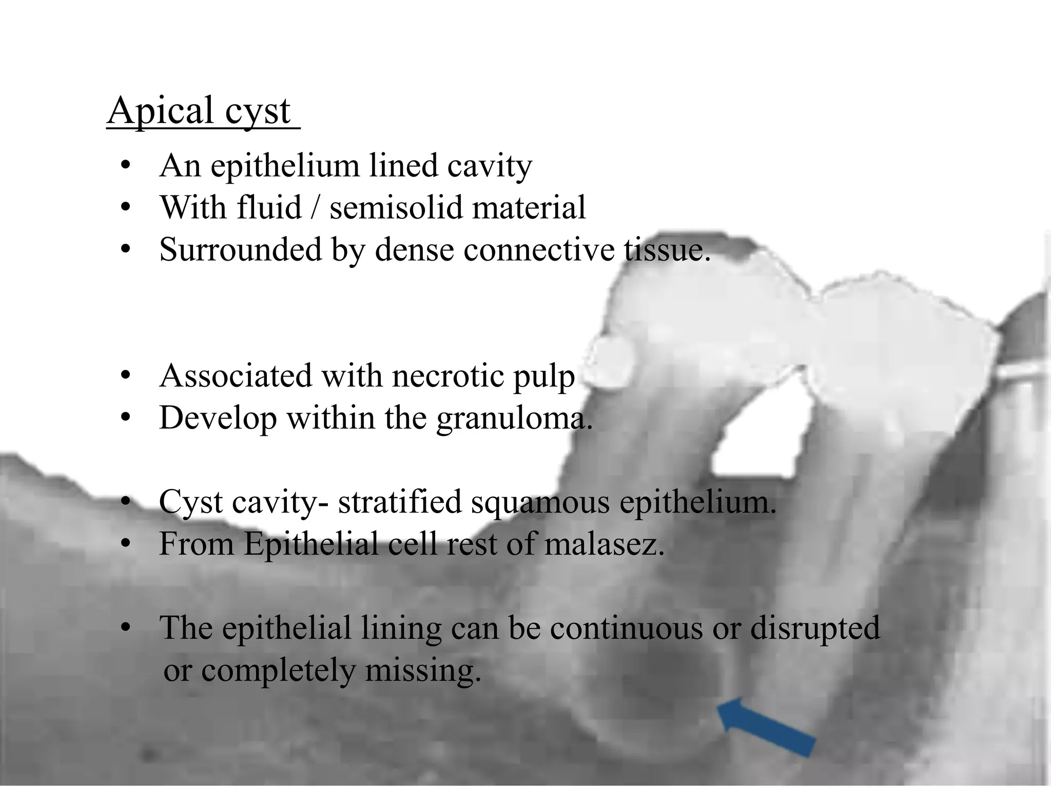 The Rationale of Enodontics | PPTX
