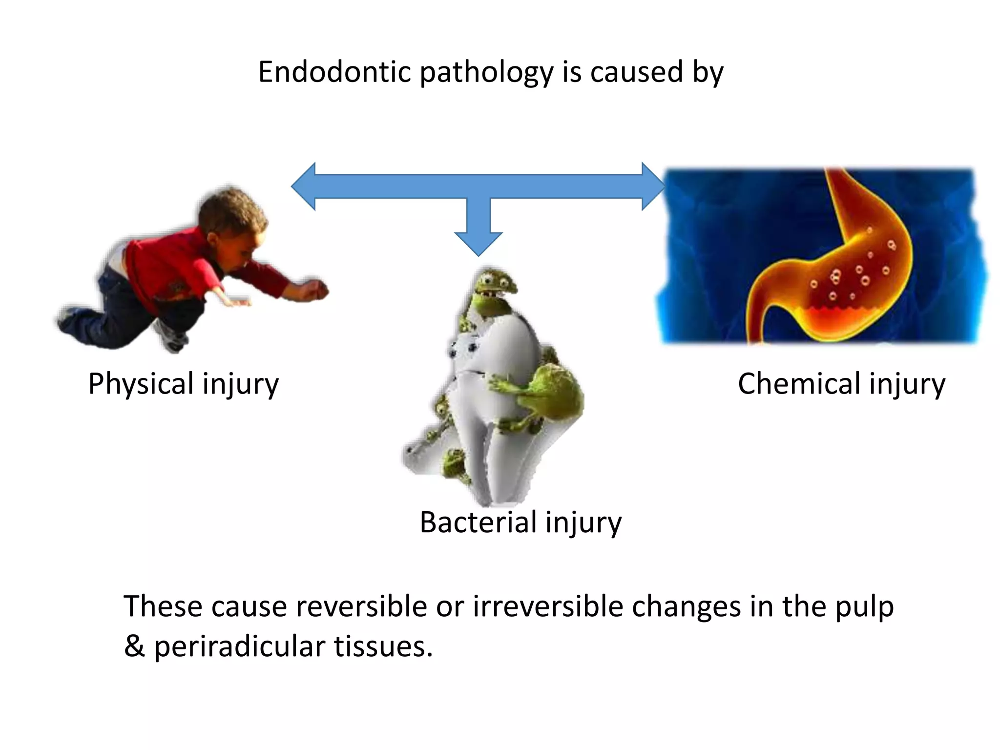 The Rationale of Enodontics | PPTX