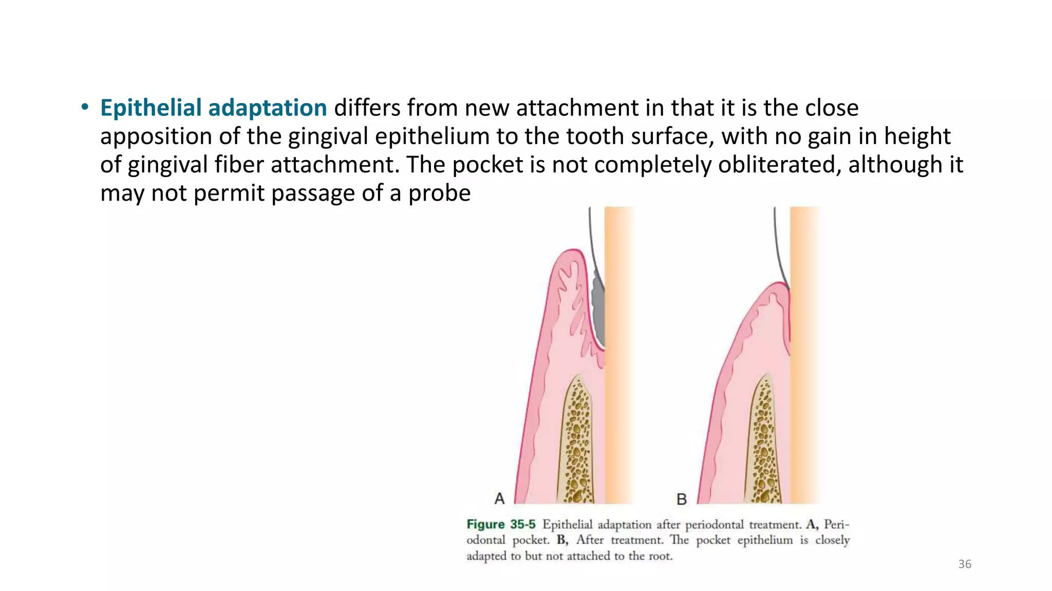 Rationale for periodontal therapy | PPTX