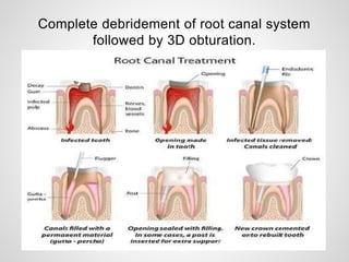 rationaleofendodontictreatment-191120103352.pdf