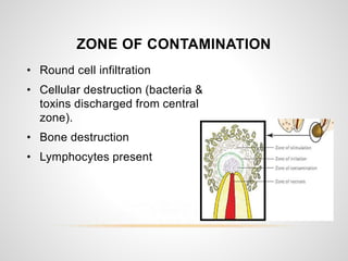 Rationale of endodontic treatment | PPTX