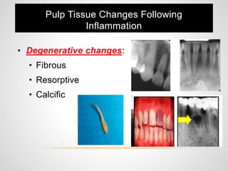 Rationale of endodontic treatment | PPTX