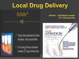 Nonsurgical Periodontal Therapy | PPTX