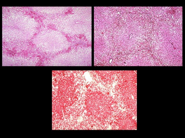 Rodenticide Poisoning + Rat Killer paste poisoning management | PPTX ...