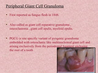 Peripheral Giant Cell Granuloma Vs Pyogenic Granuloma
