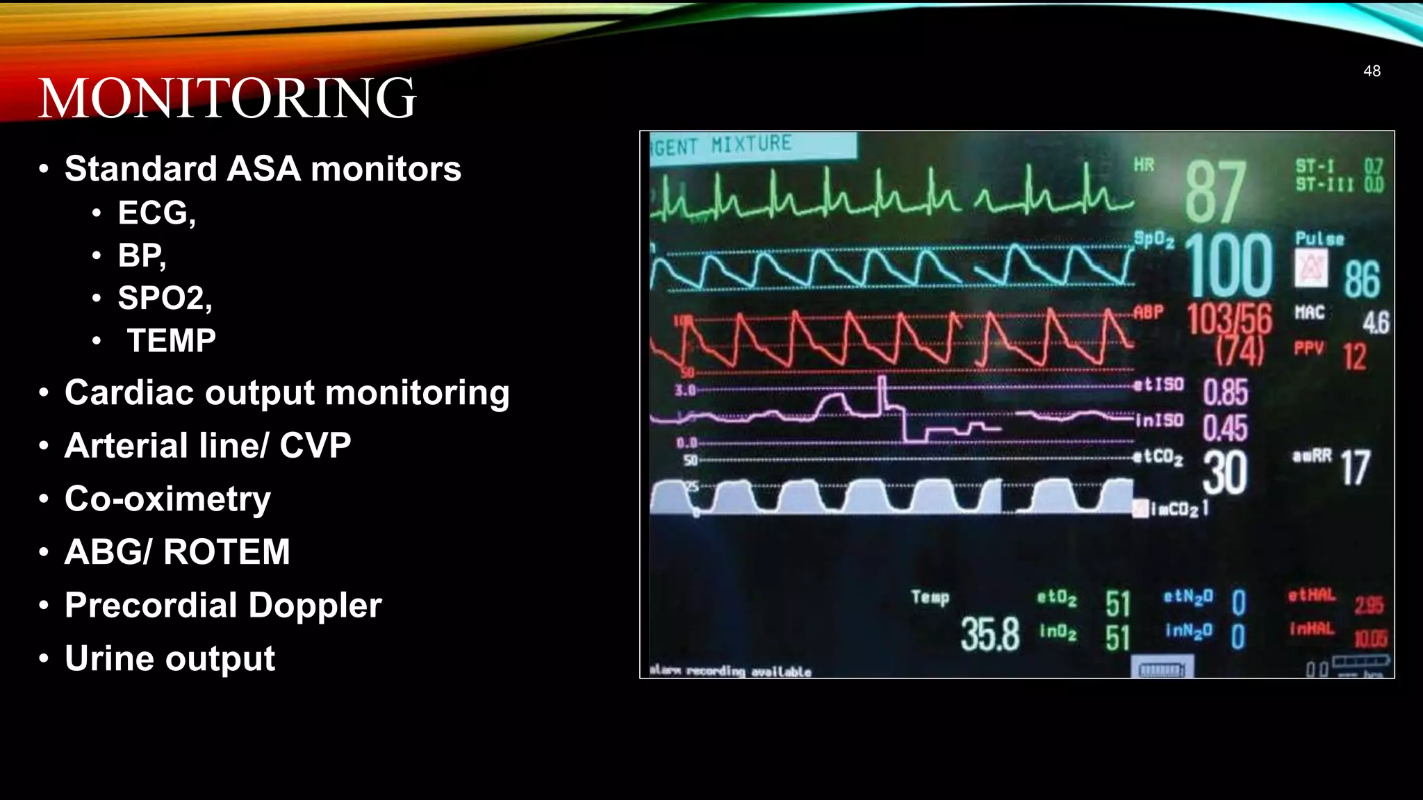 Anesthesia management of Craniosynostosis | PPTX