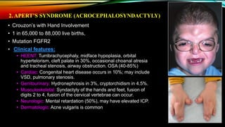 Anesthesia management of Craniosynostosis | PPTX