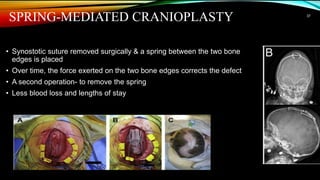 Anesthesia management of Craniosynostosis | PPTX