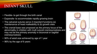 Anesthesia management of Craniosynostosis | PPTX
