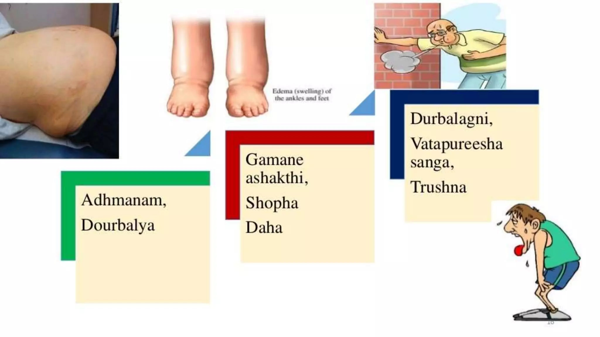 udara roga ascites | PPTX
