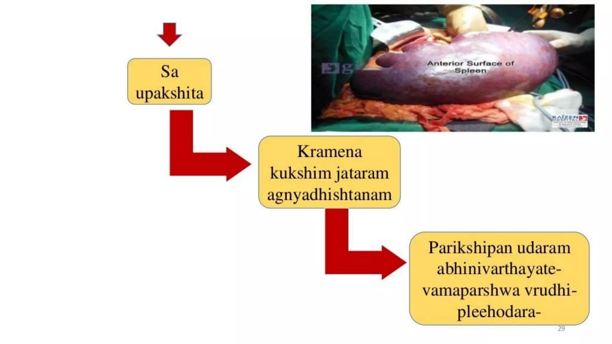 udara roga ascites | PPTX