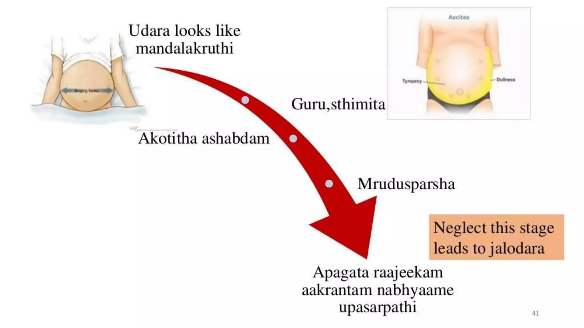 udara roga ascites | PPTX