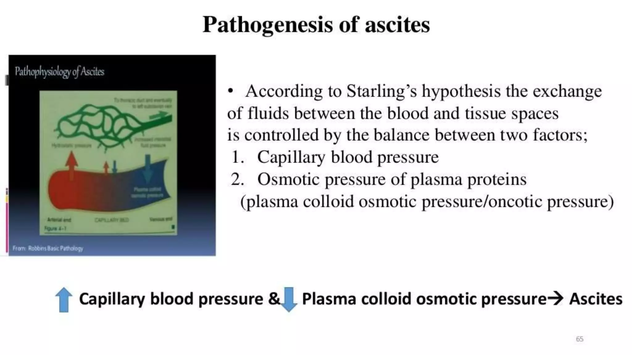 udara roga ascites | PPTX