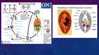 Food Borne Parasites and their control | PPTX