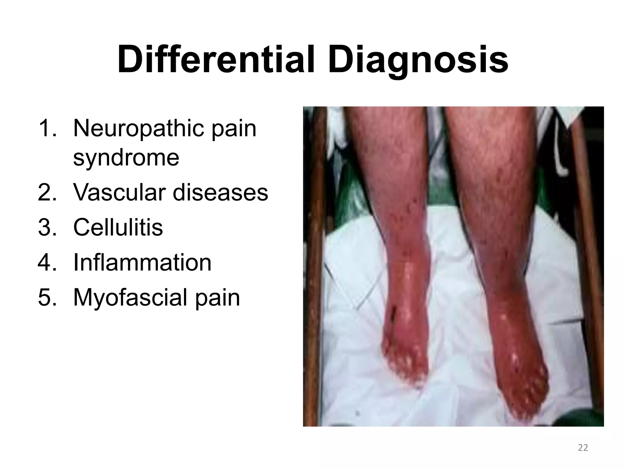 complex regional pain syndrome. C.R.P.S | PPTX