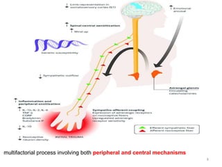 complex regional pain syndrome. C.R.P.S | PPTX