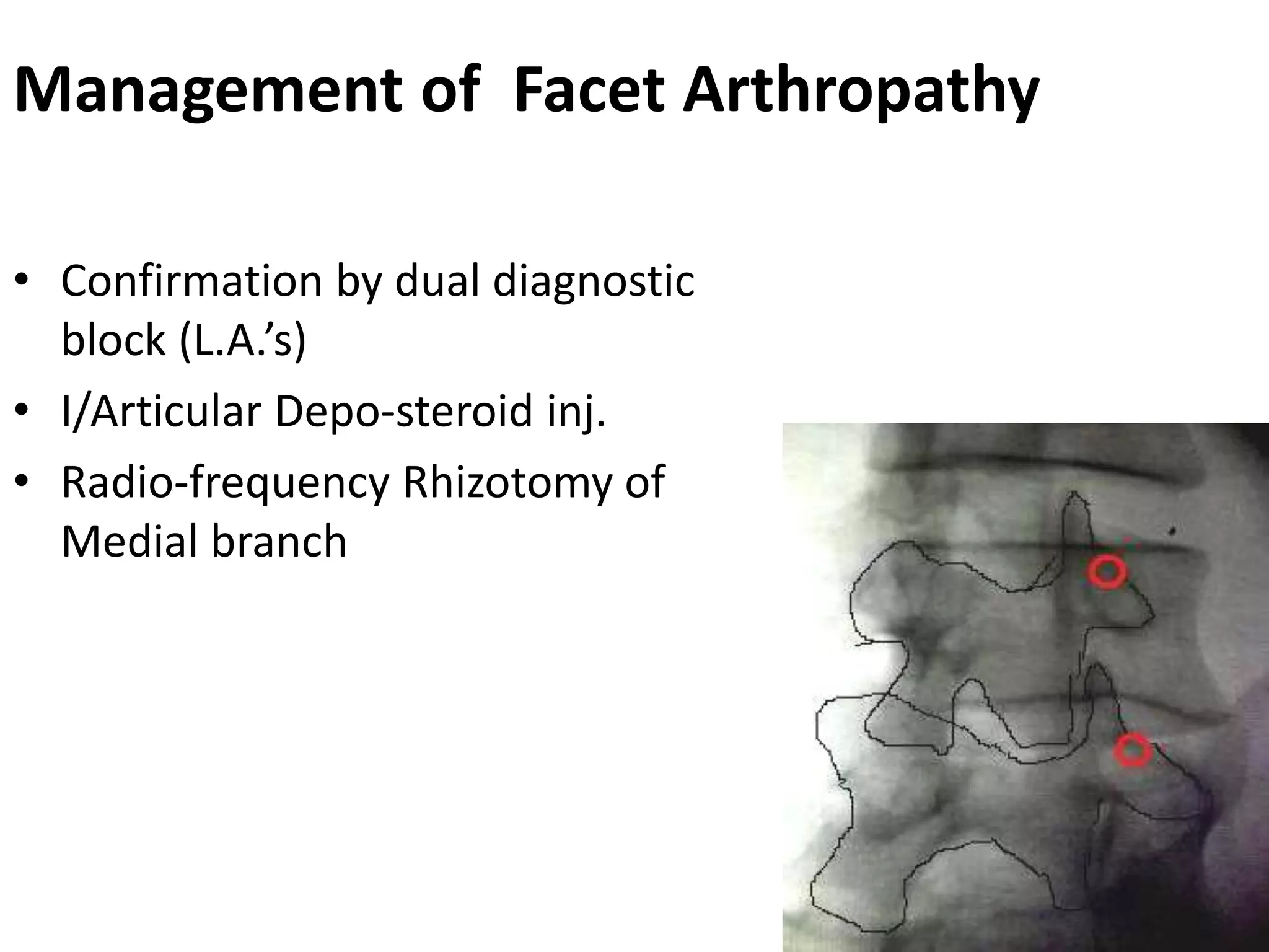 back pain algorithm ravi | PPT