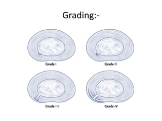 back pain algorithm ravi | PPT