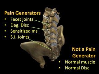 back pain algorithm ravi | PPT