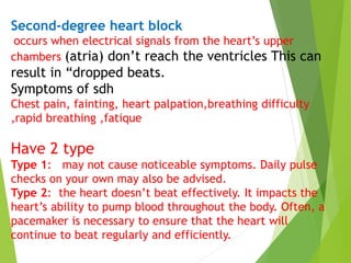 heart block presentation (1) | PPTX