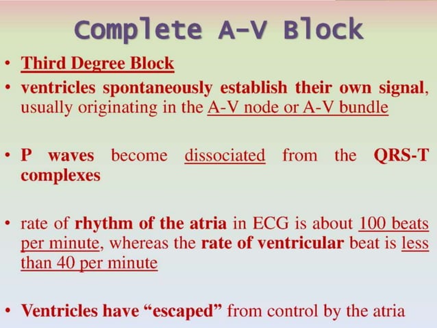 heart block presentation (1) | PPTX | Heart and Cardiovascular Diseases ...