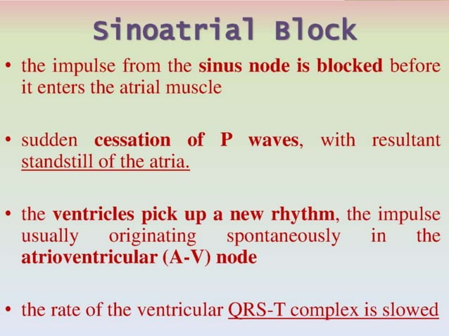 heart block presentation (1) | PPTX | Heart and Cardiovascular Diseases ...