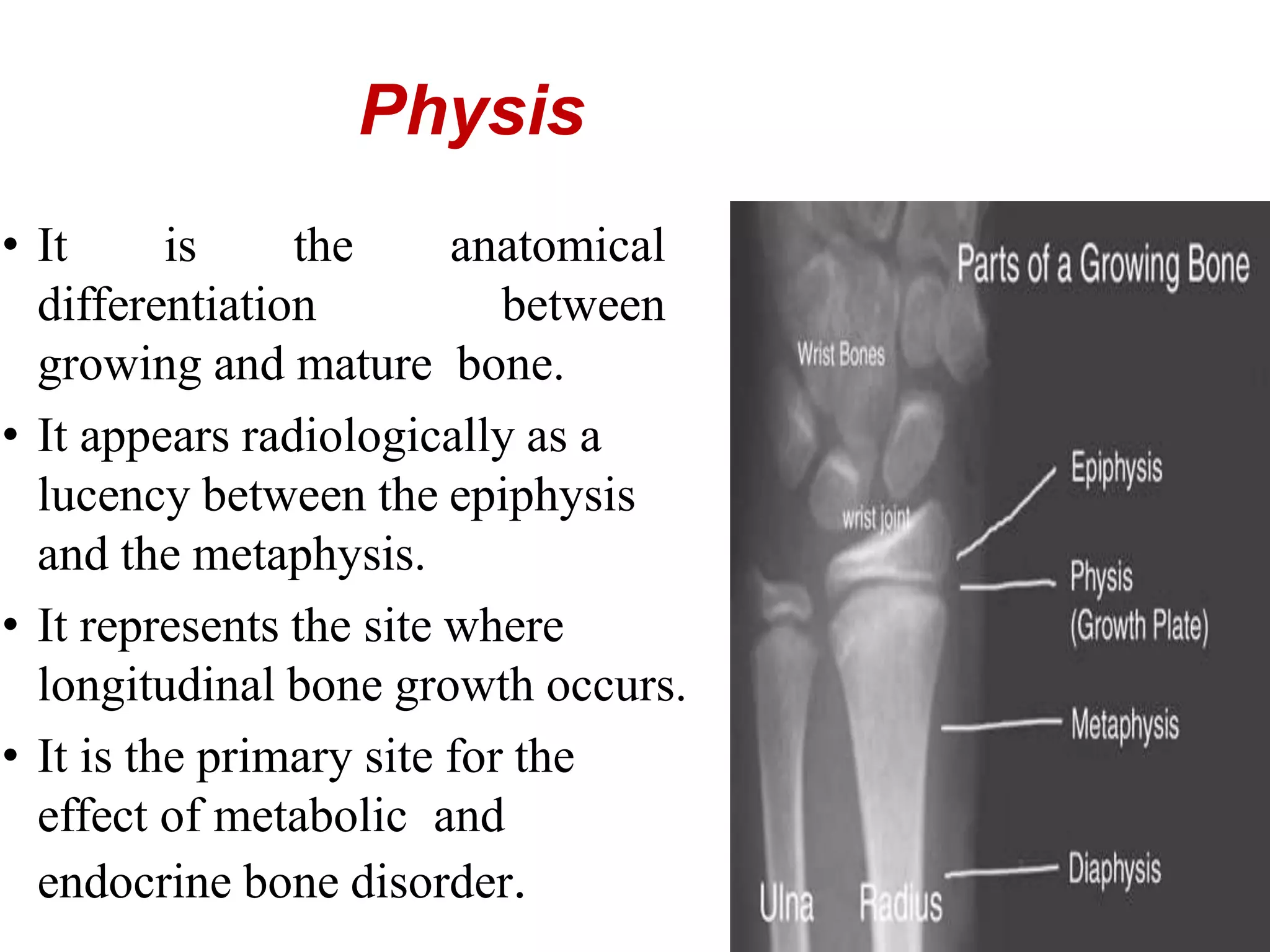Metabolic Bone Diseases - RAVI | PPTX