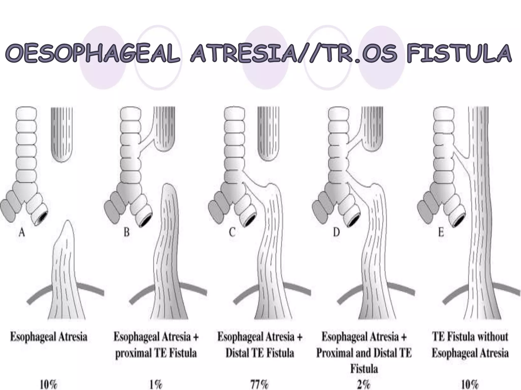 anatomy of esophagus by dr ravindra daggupati | PPTX