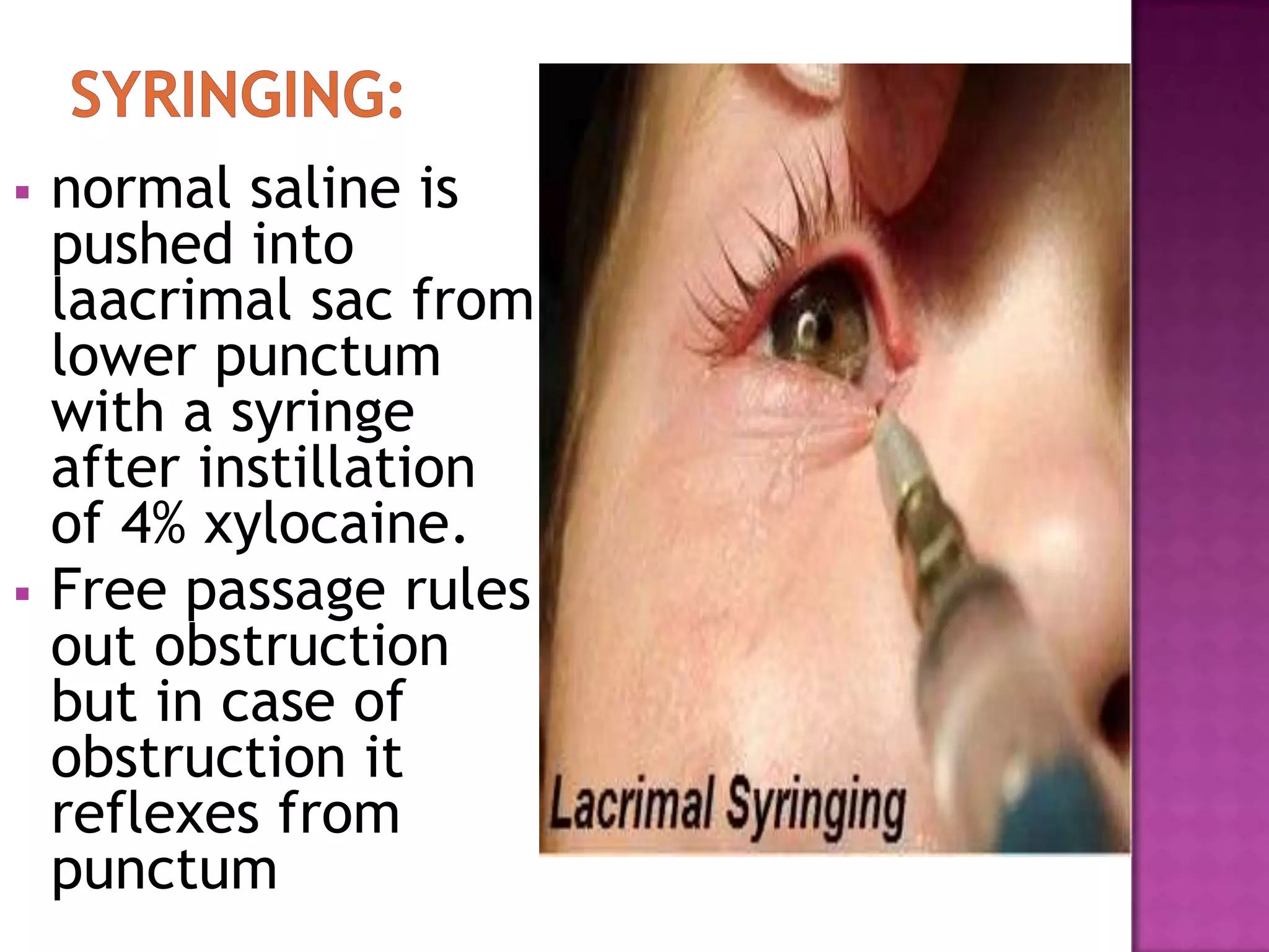 DACROCYSTORHINOSTOMY(D.C.R.)by dr.ravindra | PPTX