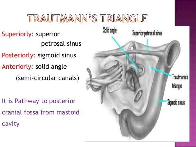 OTOGENIC BRAIN ABSCESS by dr.ravindra