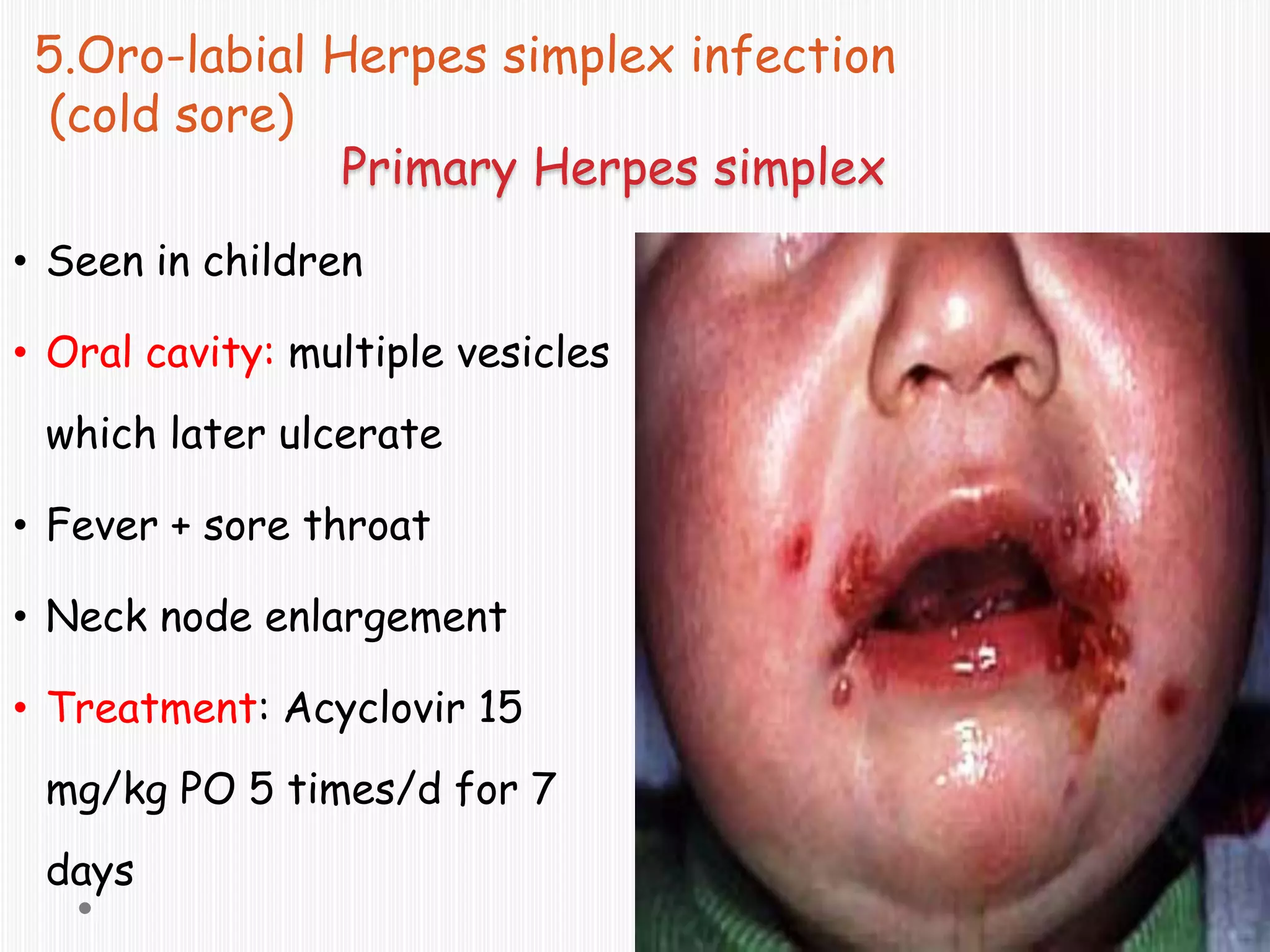 common oral lesions by ravindra daggupati | PPTX