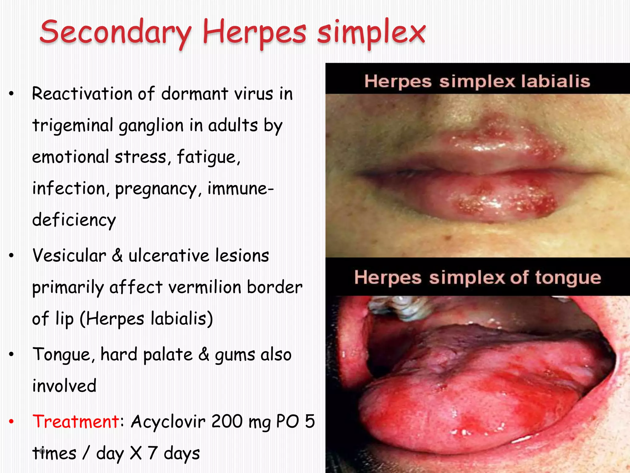 common oral lesions by ravindra daggupati | PPTX