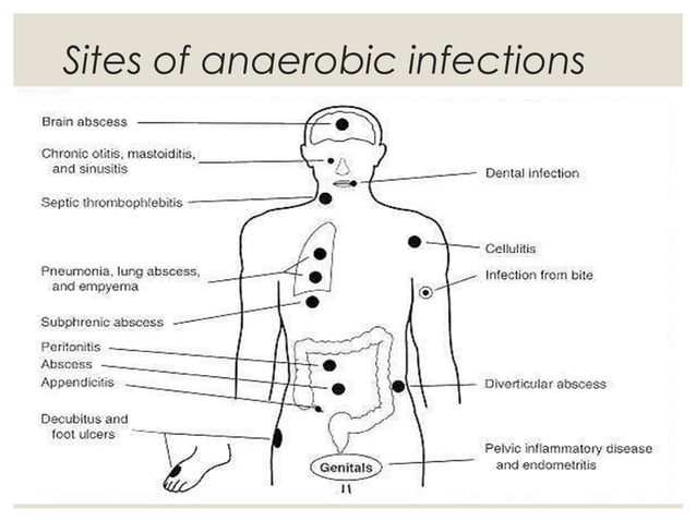 anaerobic infection ppt. | PPT | Digestive Disorders | Diseases and ...