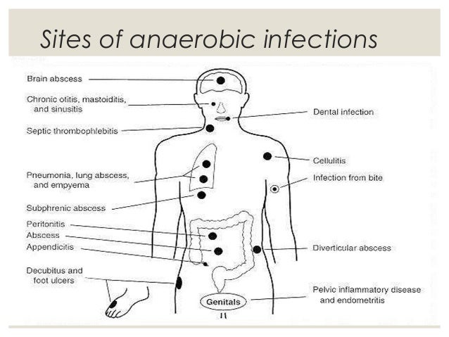 anaerobic infection ppt.