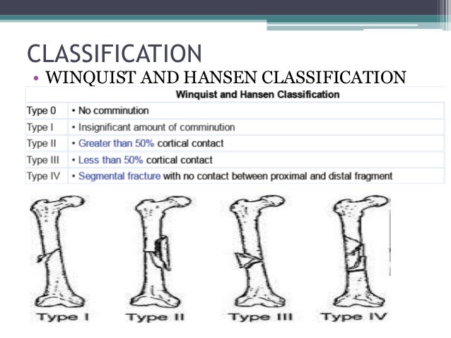 paediatric hip and femur fractures seminar by rv