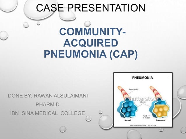 CAP (Community Acquired Pneumonia ) | PPTX | Lung and Respiratory ...