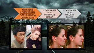Rawatan Estetik dan Pembedahan Plastik CTU211 | PPTX