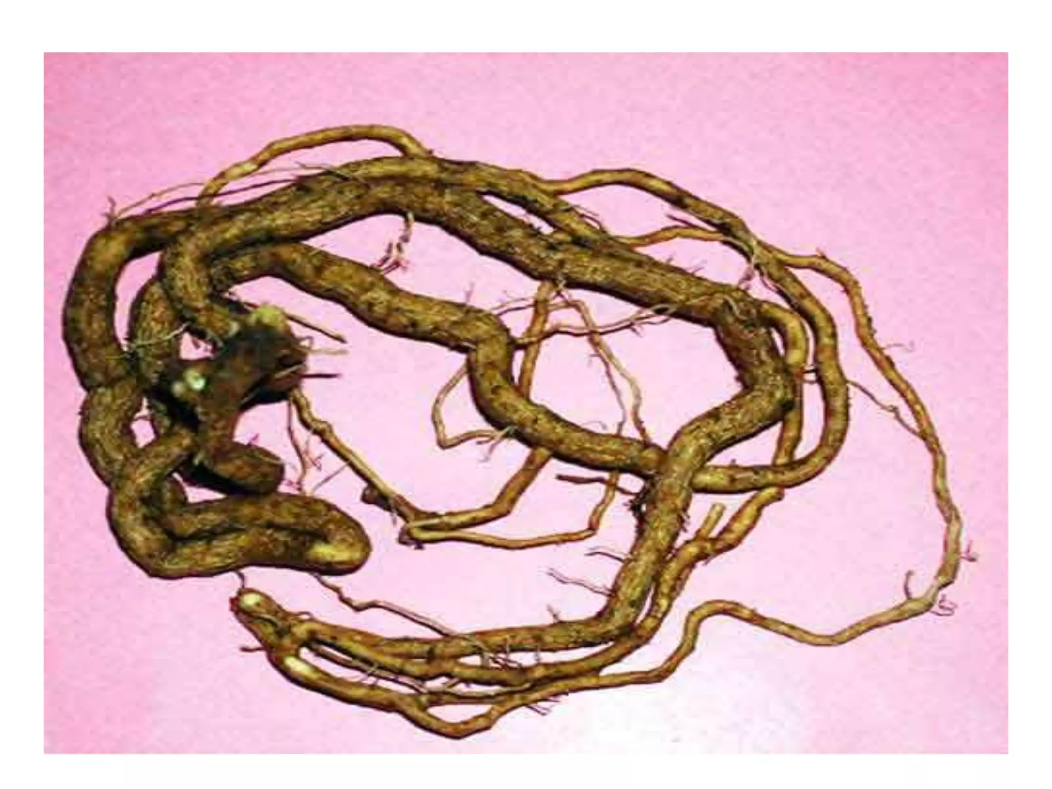 Rawolfia serpentina indian snake root ppt y.vani